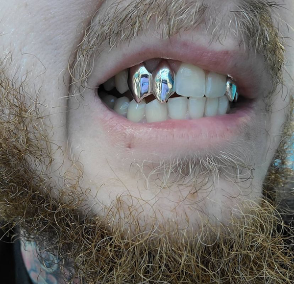 Wearing Silver Custom Grillz
