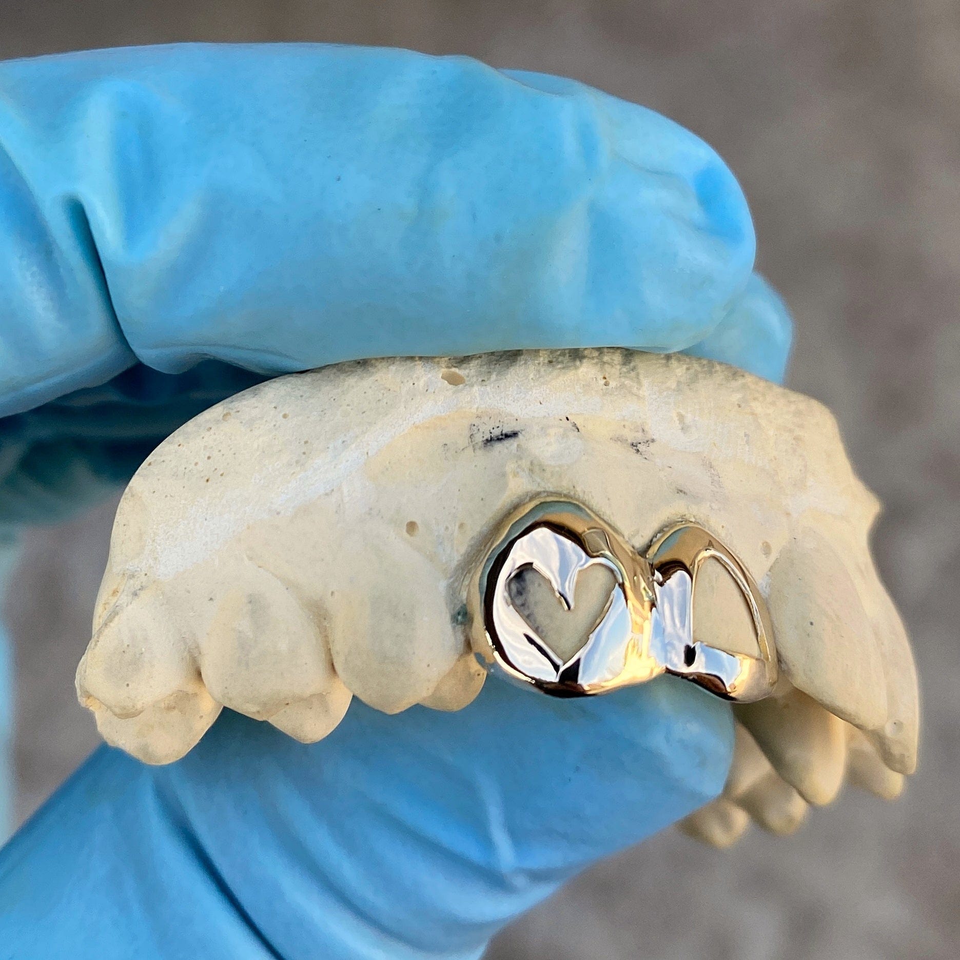 10K Gold Double Cap Heart Cutout & Open Face Tooth Custom Grillz