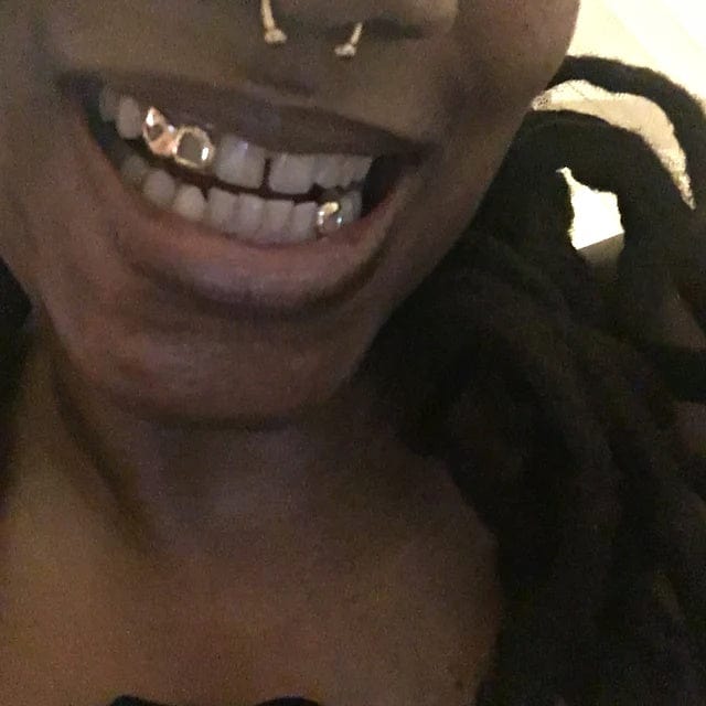 10K Gold Double Cap Heart Cutout & Open Face Tooth Custom Grillz