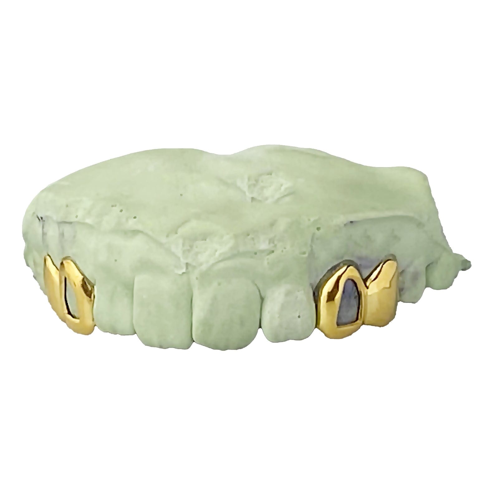 10K Gold Double Open/Solid Custom Caps (Canine & 1st Premolar)