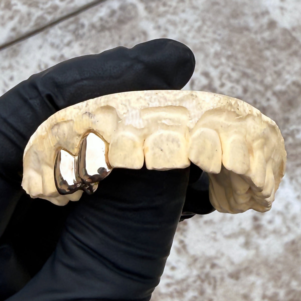 10K or 14K Solid Gold Custom Double Caps (Canine & 1st Premolar)