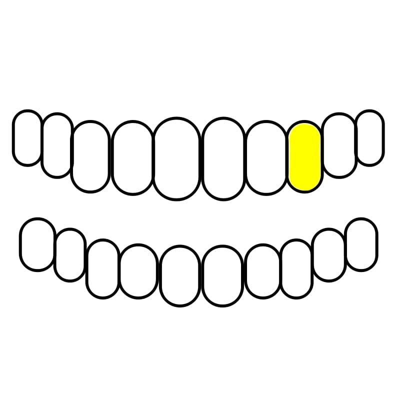 Real 925 Silver Single Cap Boat Anchor Laser Engraved Custom Tooth Cap