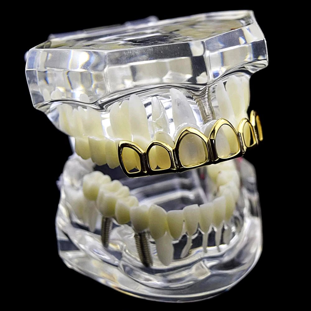 14K Gold Plated 6 Open Face Top Teeth Grillz