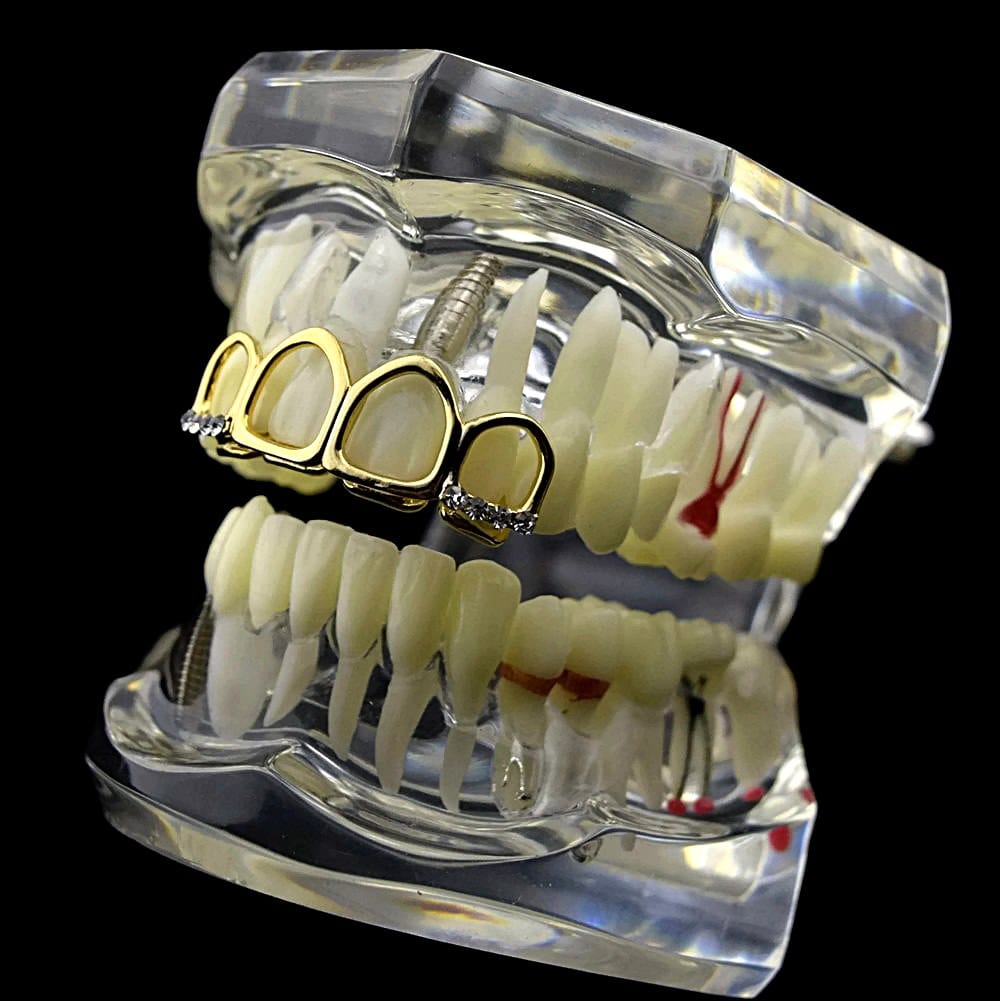 14K Gold Plated All Four Open Face Iced Top Teeth Grillz