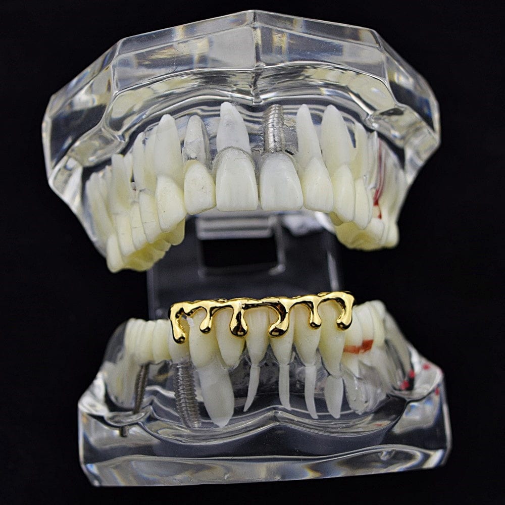 14K Gold Plated Bottom Teeth Melting Dripping Drip Grillz