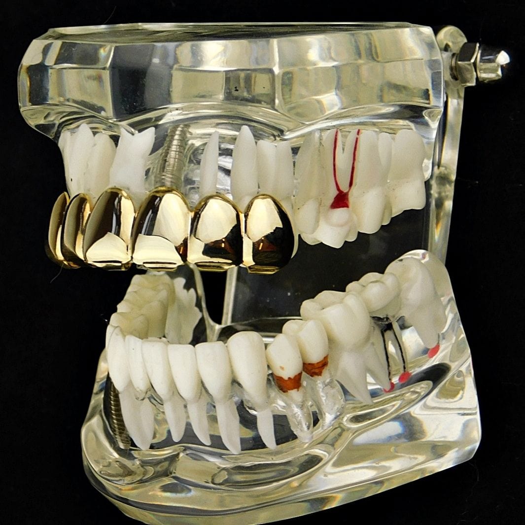 14K Gold Plated Deeper-Cut Top Teeth Plain Grillz