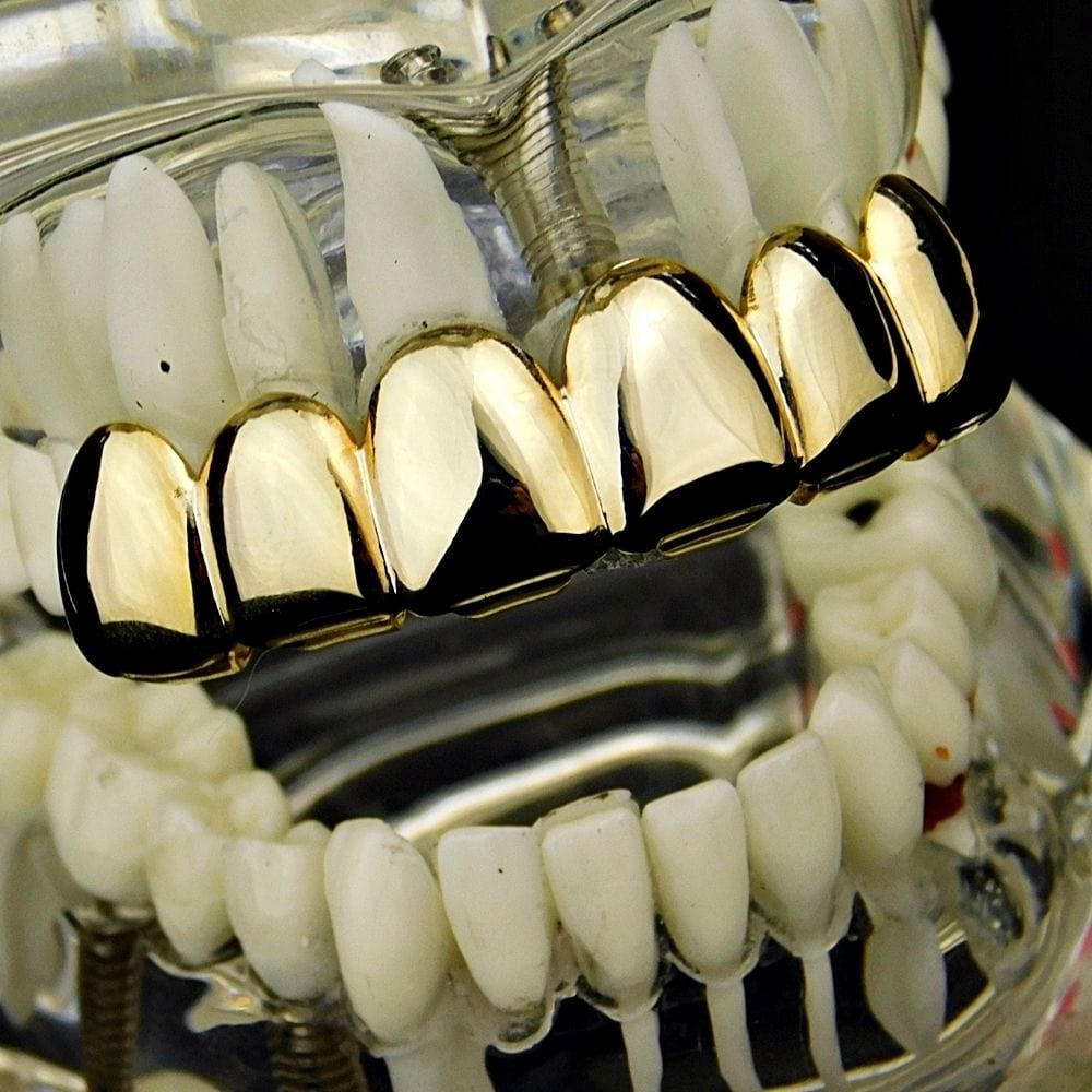 14K Gold Plated Deeper-Cut Top Teeth Plain Grillz