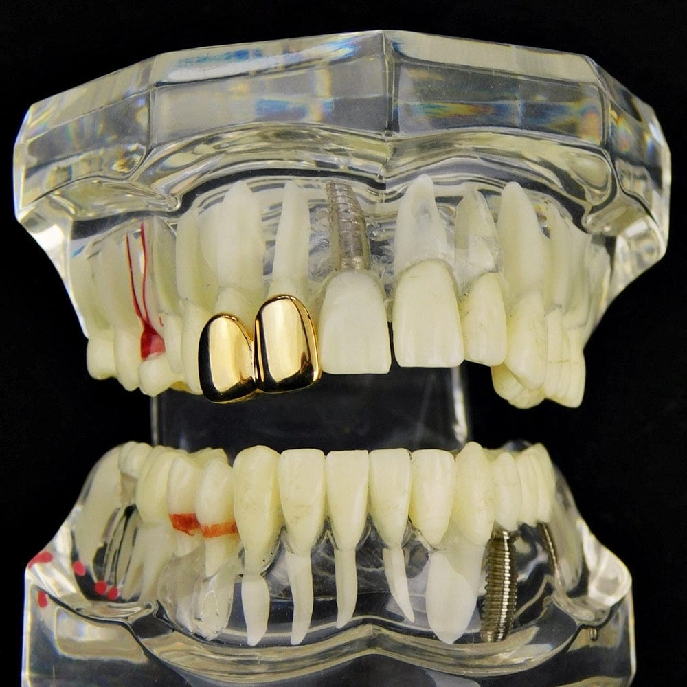 14K Gold Plated Double Caps - Right Hand Teeth