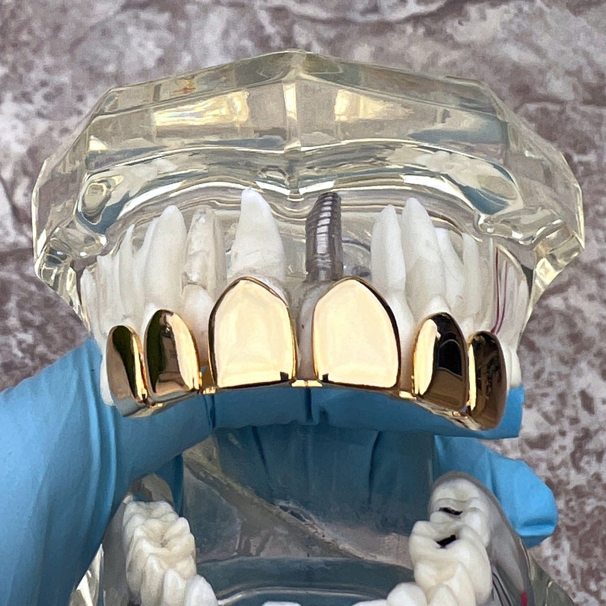 14K Gold Plated Permanent Cut Perm Cuts Top Teeth Pre-Made Grillz