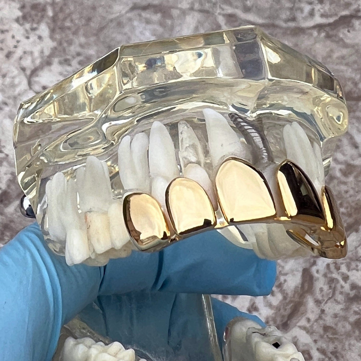 14K Gold Plated Permanent Cut Perm Cuts Top Teeth Pre-Made Grillz