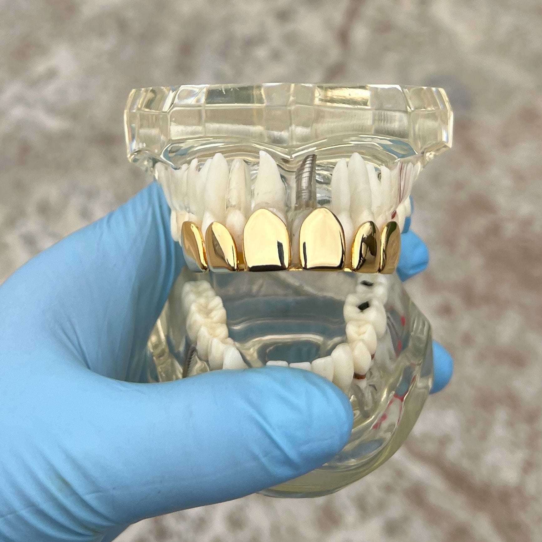 14K Gold Plated Permanent Cut Perm Cuts Top Teeth Pre-Made Grillz