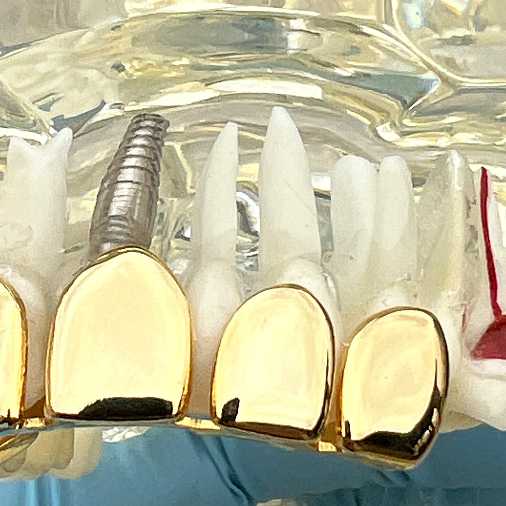 14K Gold Plated Permanent Cut Perm Cuts Top Teeth Pre-Made Grillz