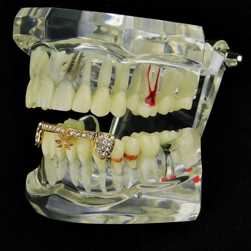 14K Gold Plated Marijuana Weed Leaf Bottom Teeth Iced Grillz