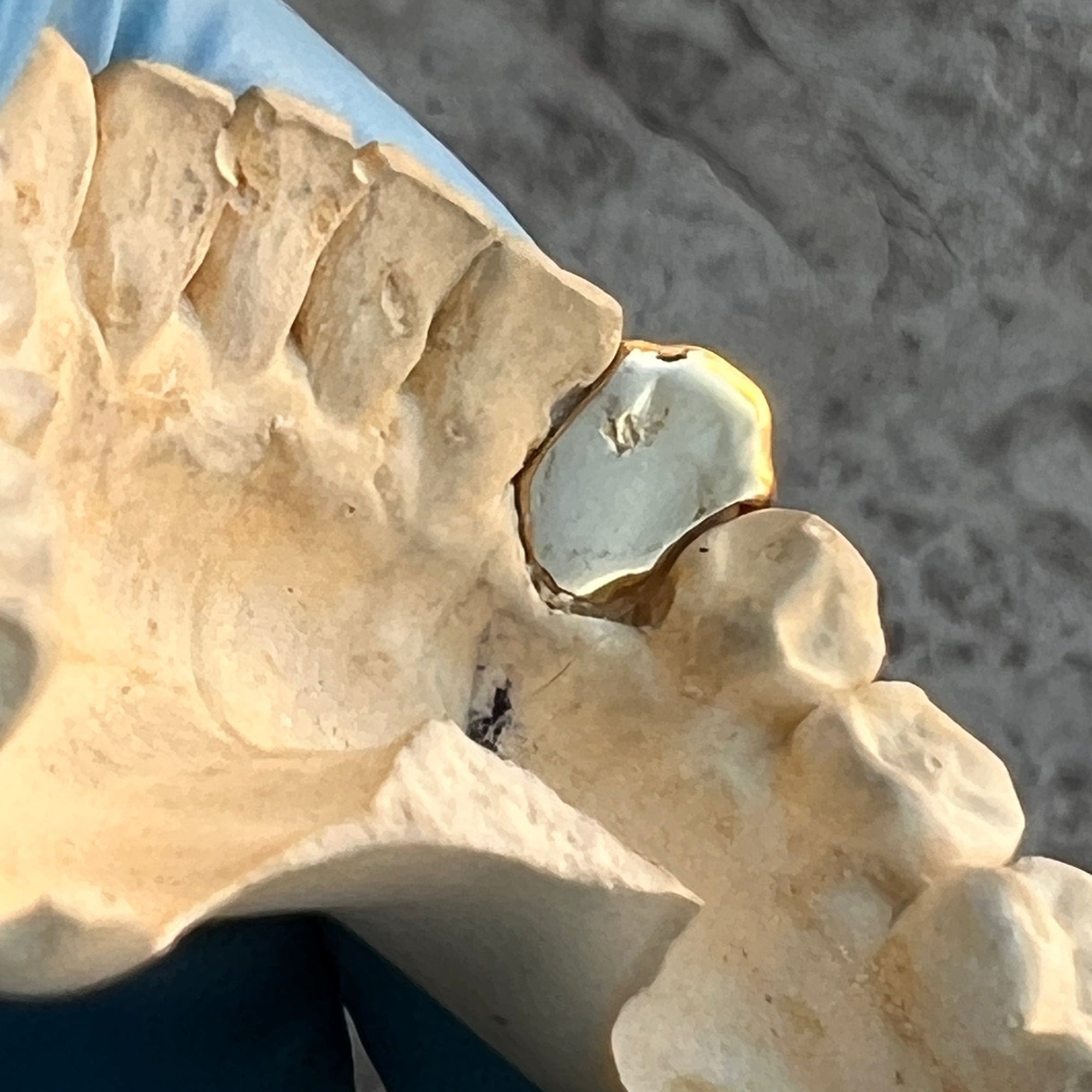 14K Gold Single Cap Gold Diamond Dust w/Border One Tooth Custom Grillz