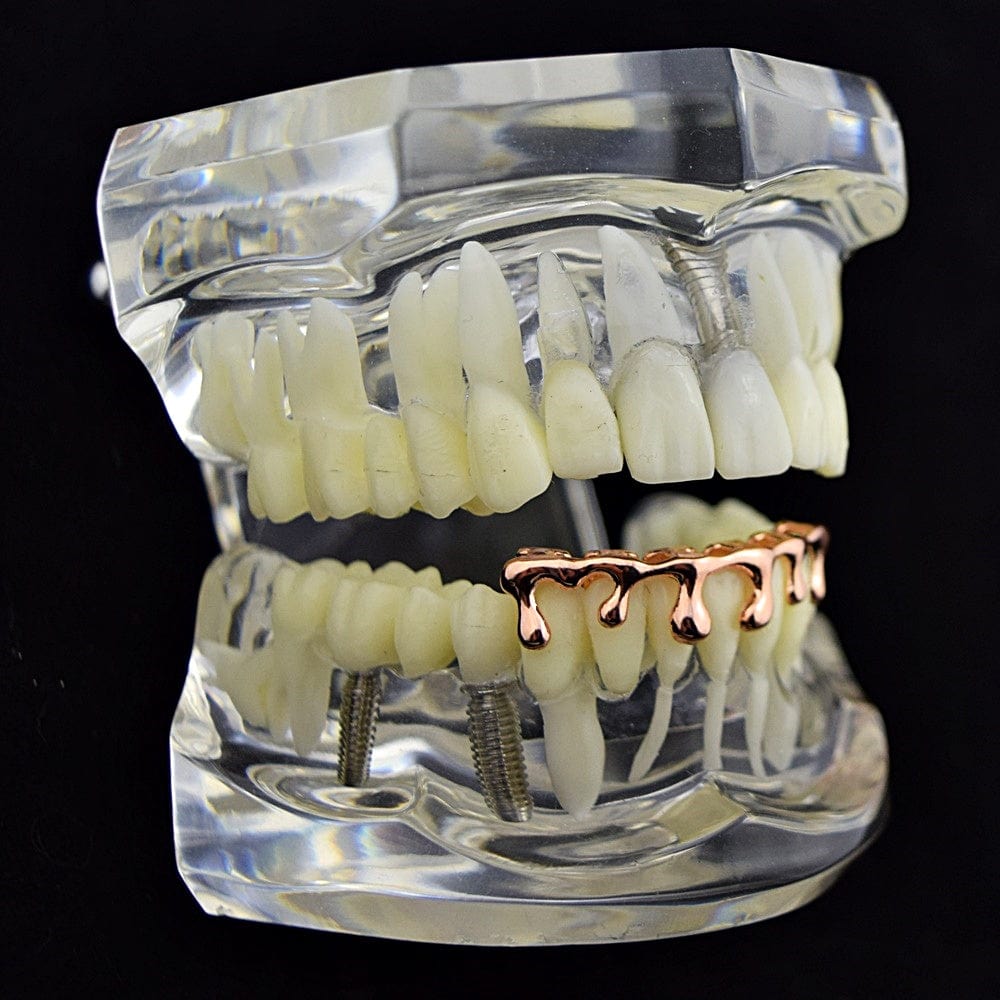 14K Rose Gold Plated Drip Bottom Teeth Grillz
