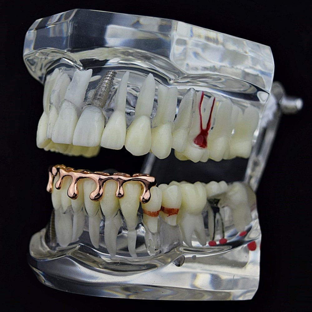14K Rose Gold Plated Drip Bottom Teeth Grillz