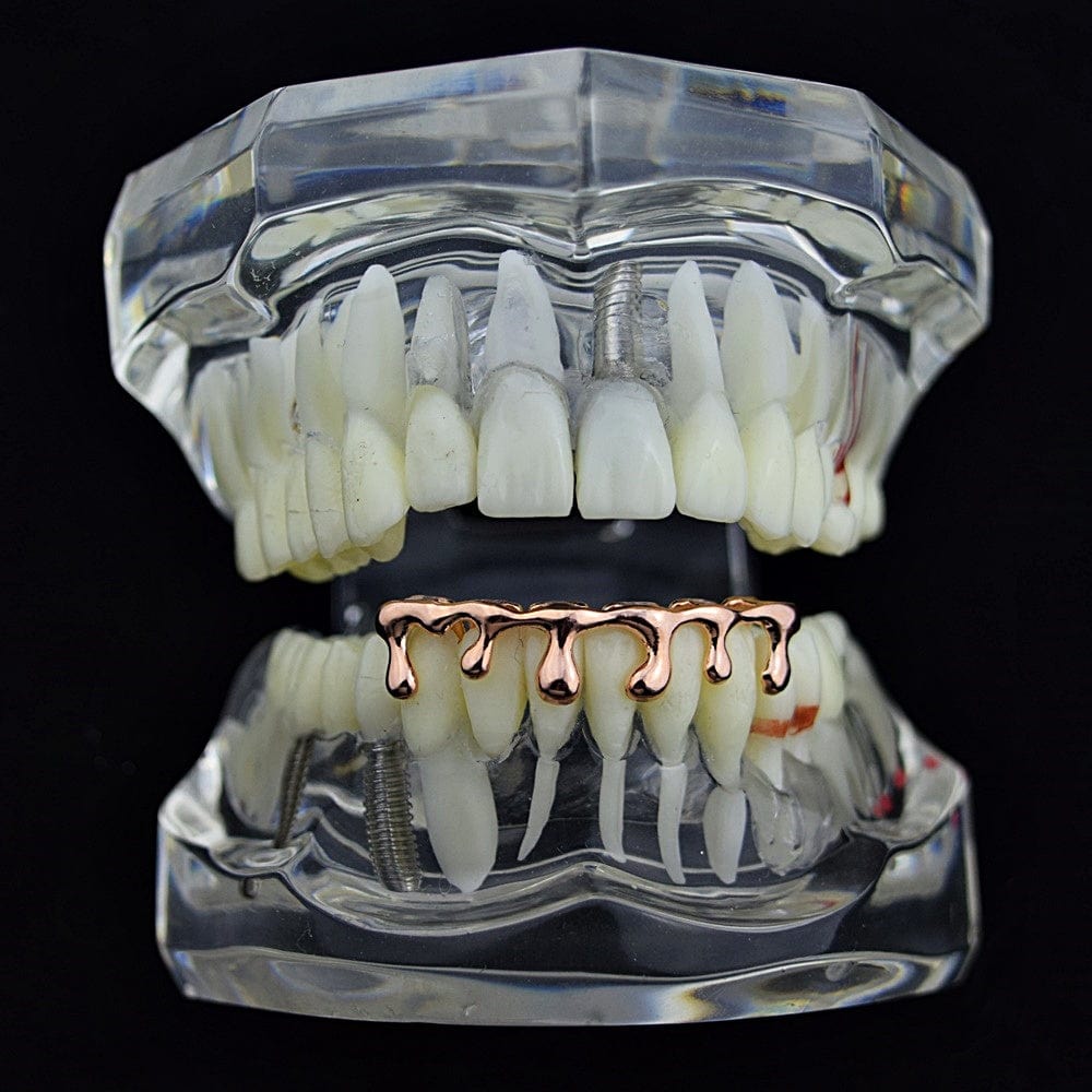 14K Rose Gold Plated Drip Bottom Teeth Grillz