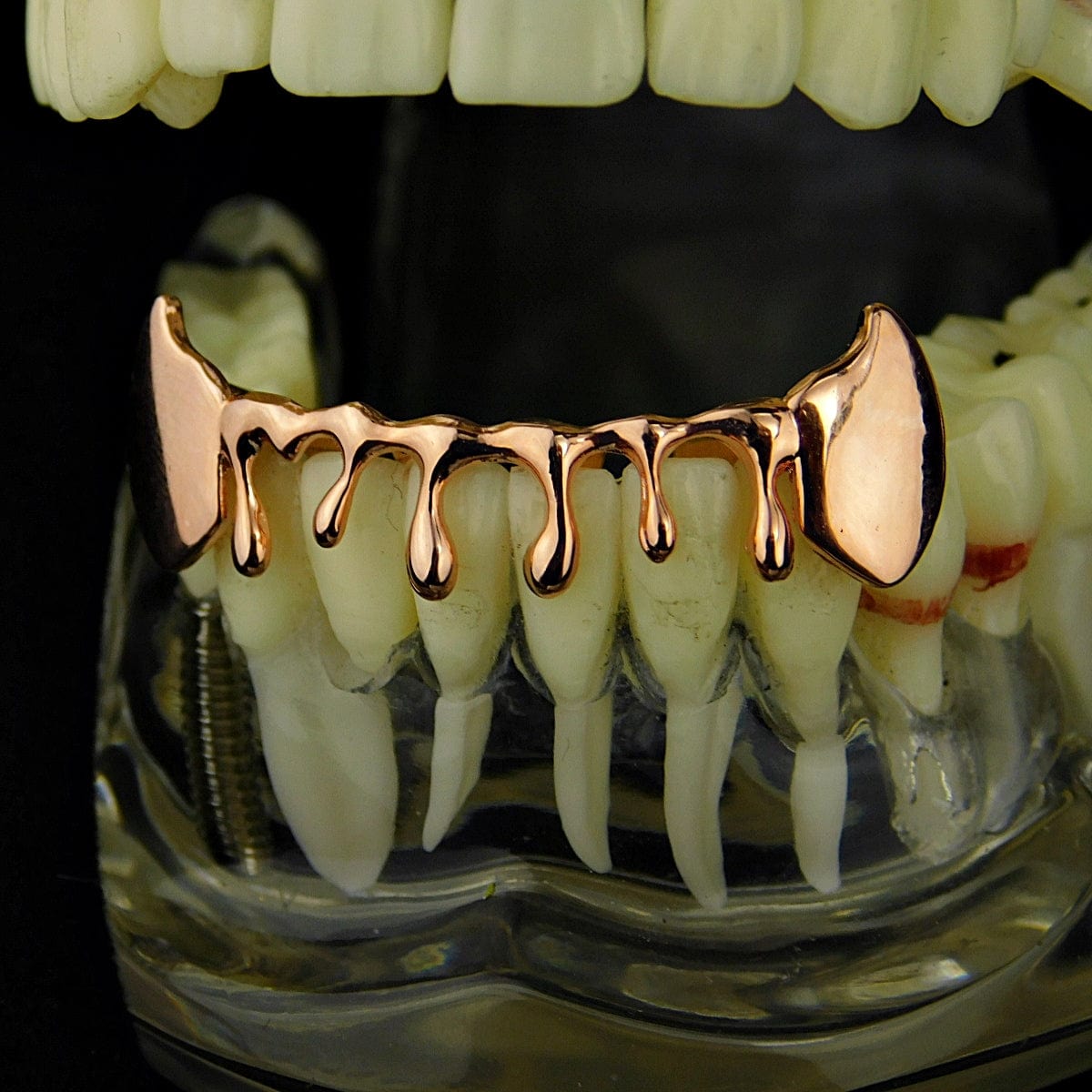 14K Rose Gold Plated Drip Bottom Vampire Fangs Grillz