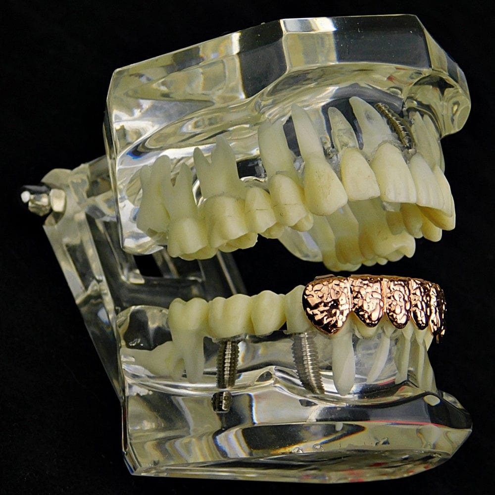 14K Rose Gold Plated Nugget Bottom Teeth Grillz