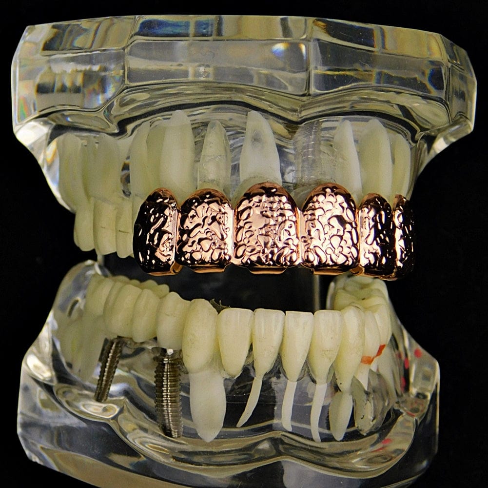 14K Rose Gold Plated Nugget Top Teeth Grillz