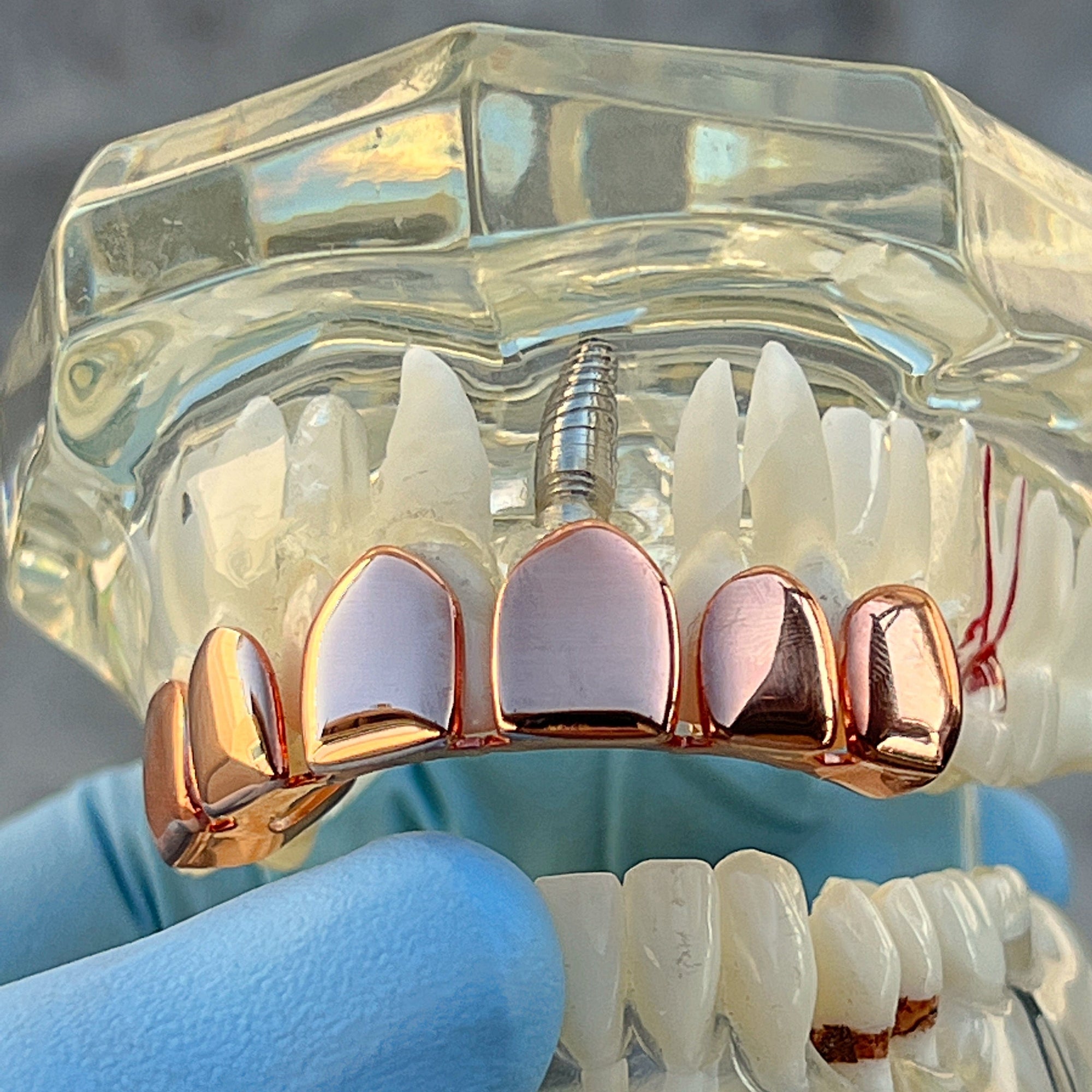 14K Rose Gold Plated Permanent Cut Perm Cuts Top Teeth Pre-Made Grillz