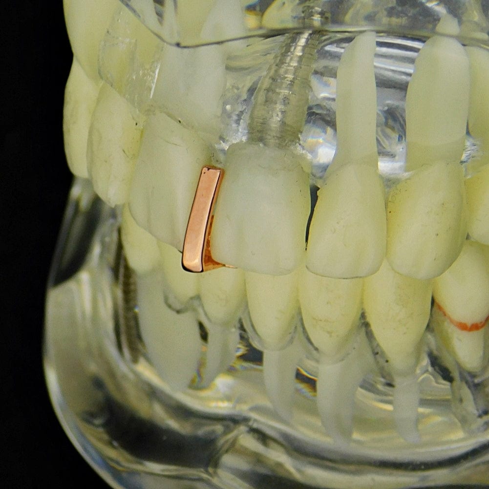 14K Rose Gold Plated Plain Gap Single Cap Tooth Grillz