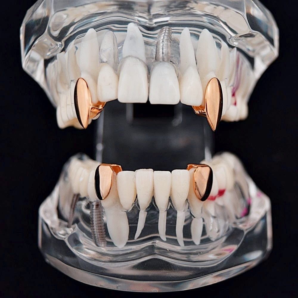 14K Rose Gold Plated Vampire Fangs & Caps Set