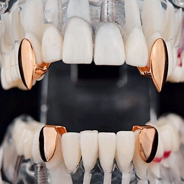 14K Rose Gold Plated Vampire Fangs & Caps Set