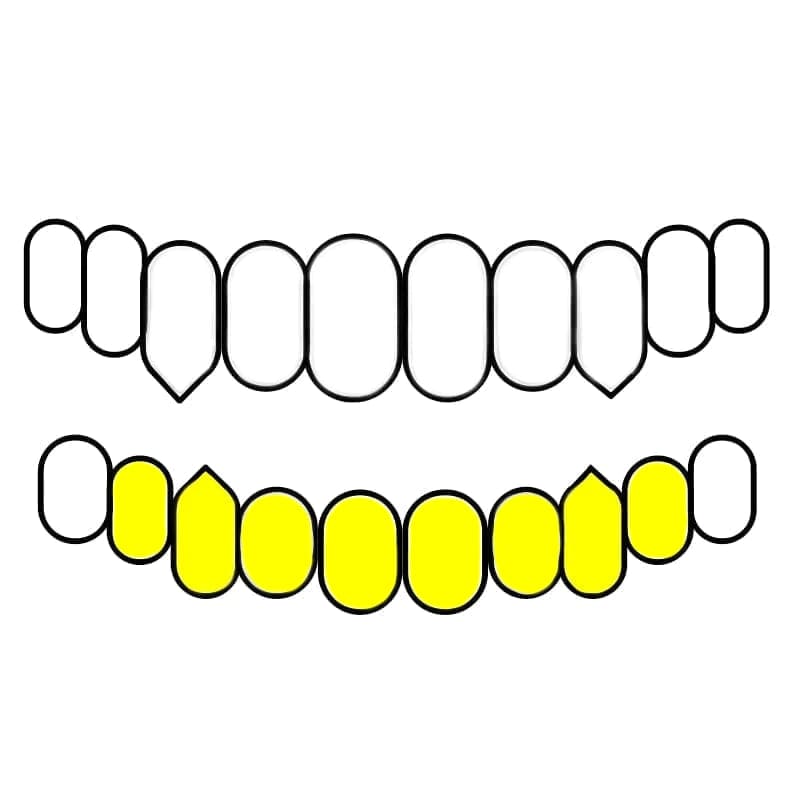 Real 10K Gold Vampire Teeth Fangs Custom Grillz