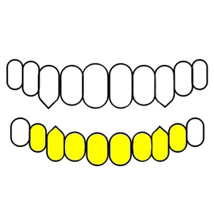 Real 10K Gold Vampire Teeth Fangs Custom Grillz
