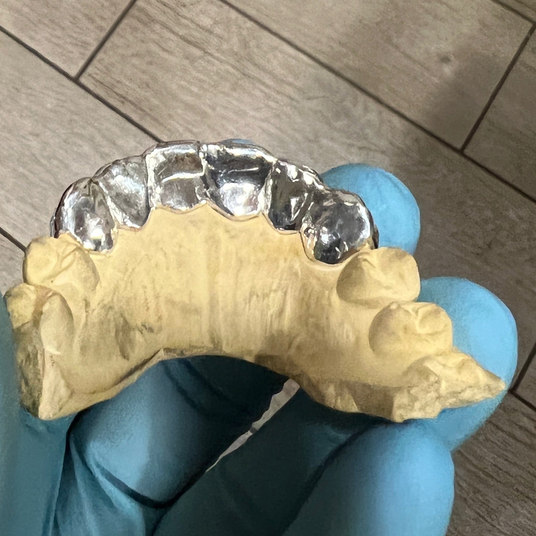 925 Silver Custom Grillz Diamond Dust With Diamond-Cuts Open Face Inci