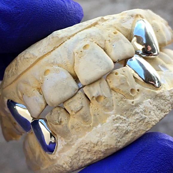 Real Solid 925 Sterling Silver Single Canine Teeth Caps