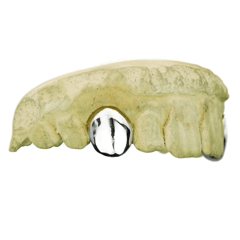 925 Sterling Silver Custom Canine Teeth Caps