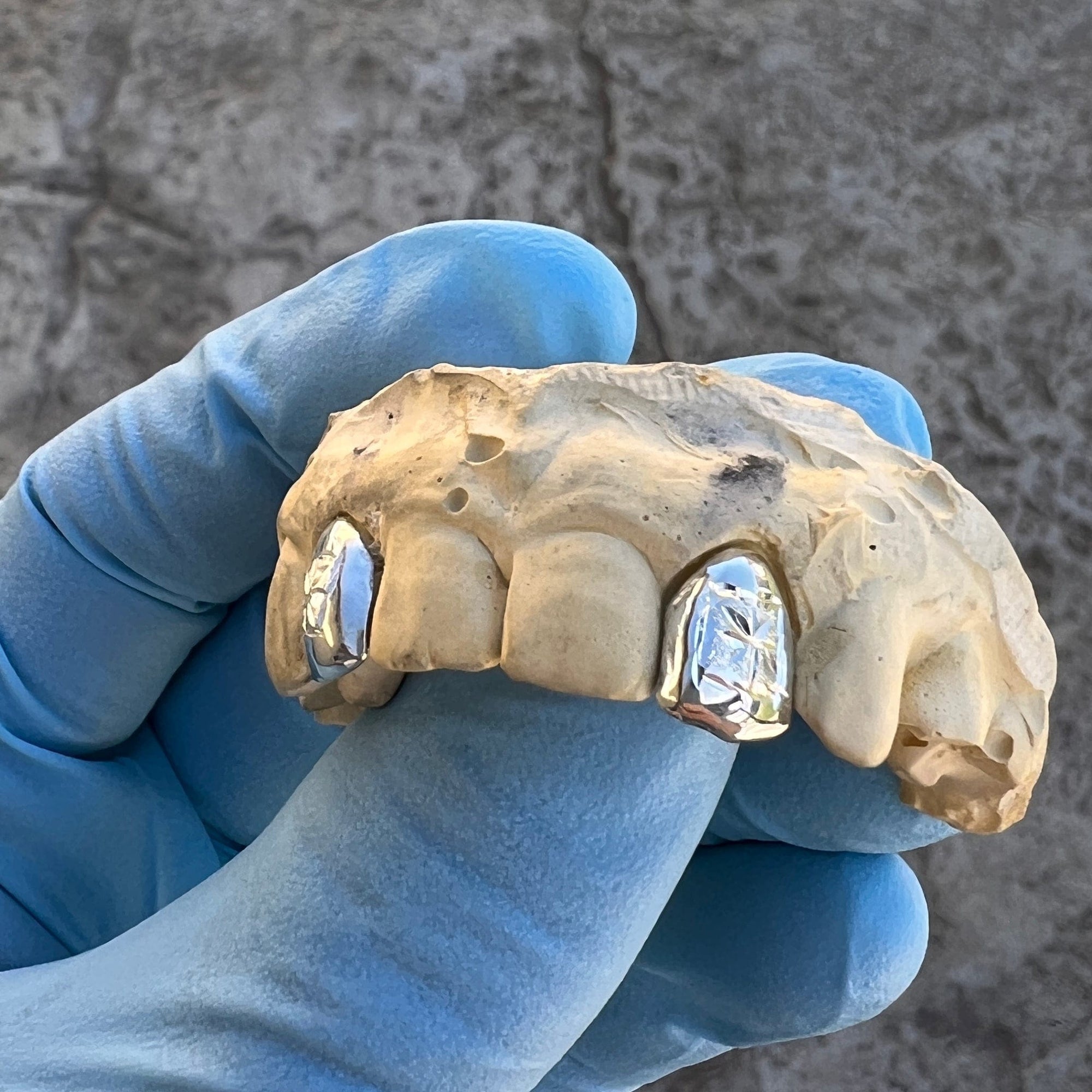 925 Sterling Silver Custom Starburst Single Cap Grillz Set Two Teeth