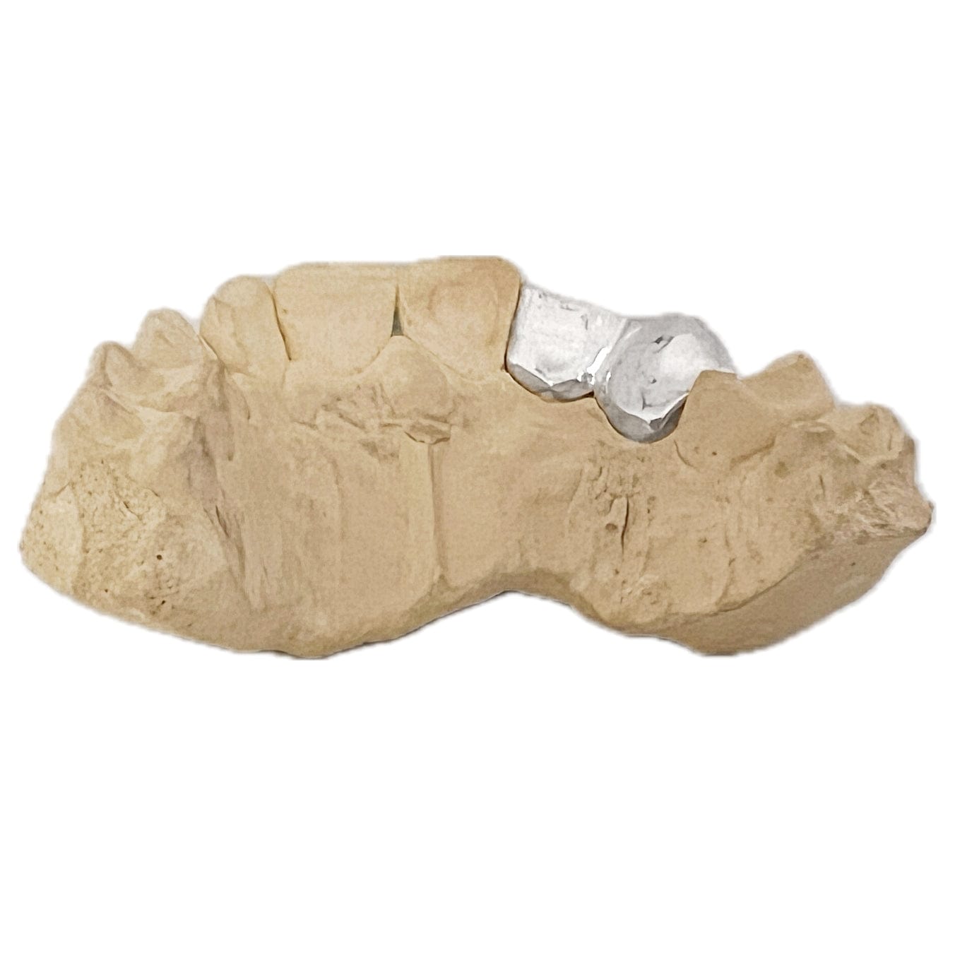 925 Sterling Silver Double Cap Heart Cutout & Open Tooth Custom Grillz