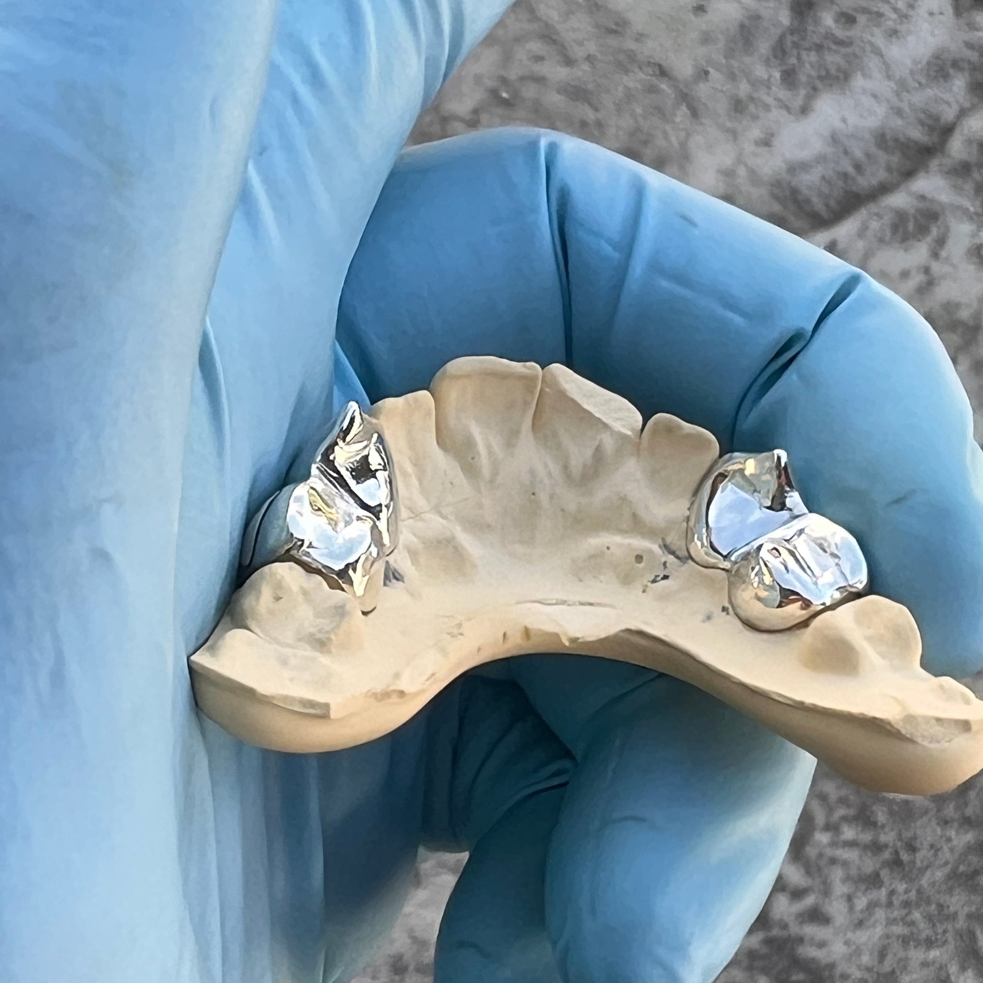 925 Sterling Silver Double Cap Vampire Fang Laser Engraved Broke Broke