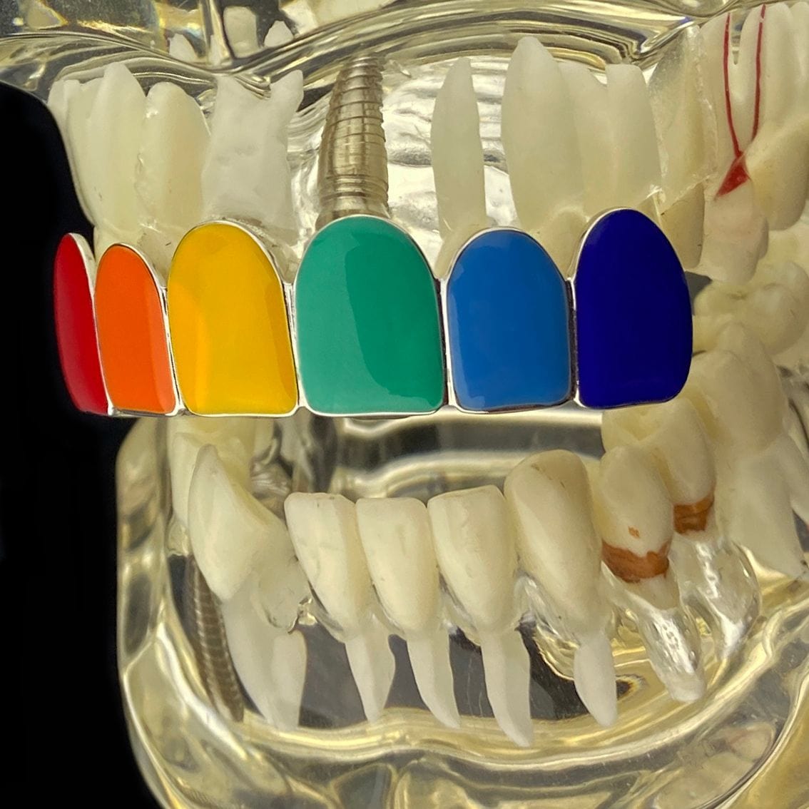 925 Sterling Silver Top Teeth Enamel Rainbow Mulit-Color Grillz