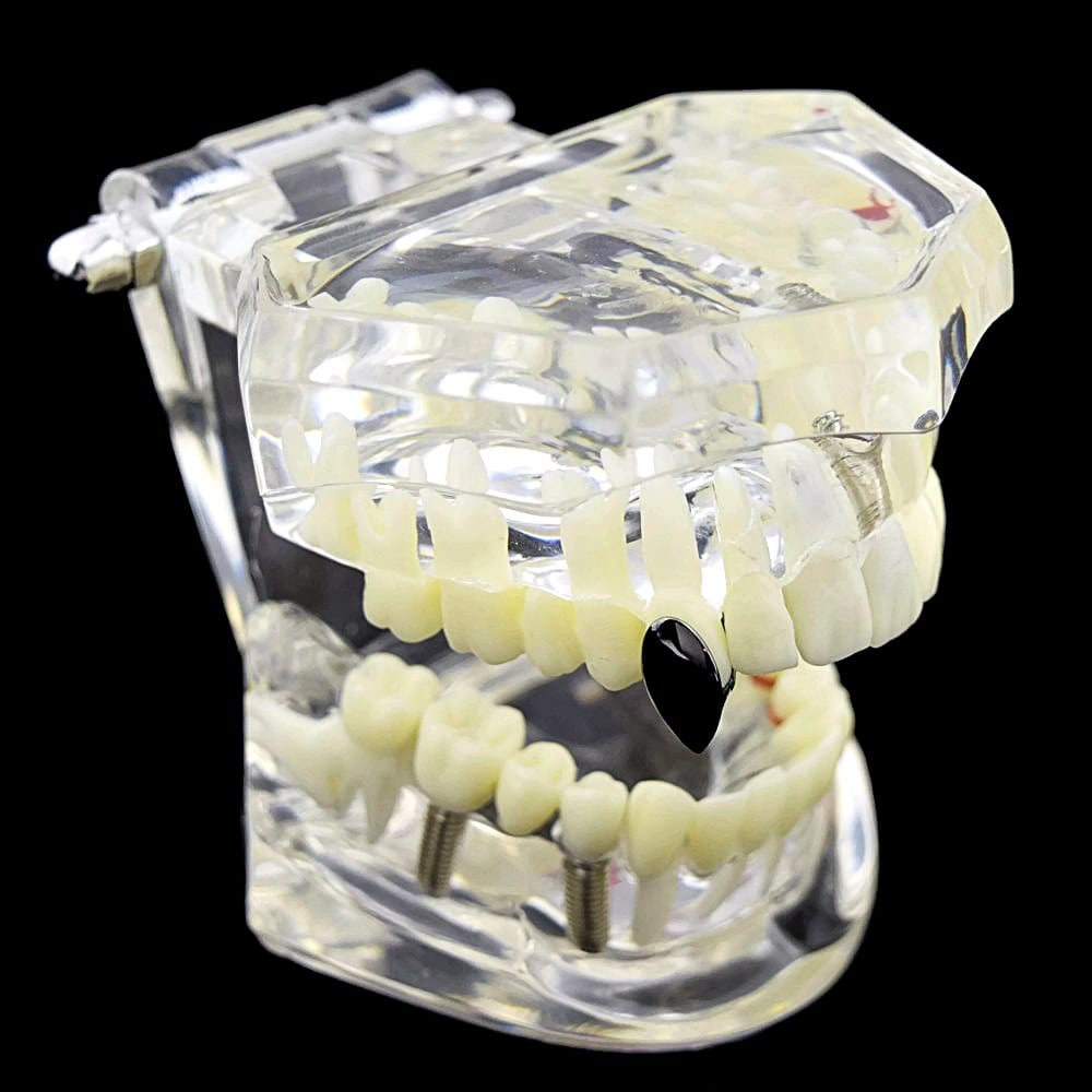 Black Plated Single Tooth Top Vampire Fang Cap