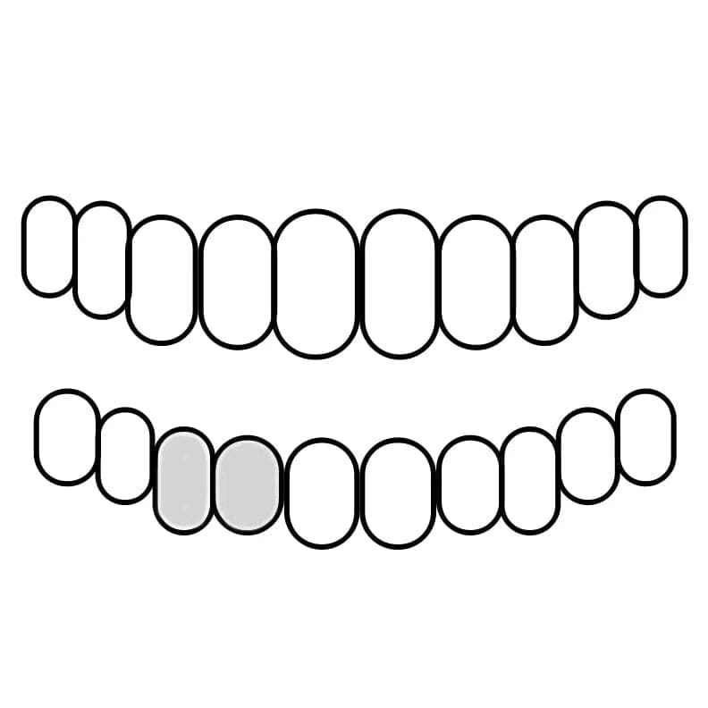 925 Sterling Silver Double Side Canine Open Face Caps Custom Grillz