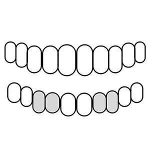 925 Sterling Silver Double Cap Heart Cutout & Open Tooth Custom Grillz