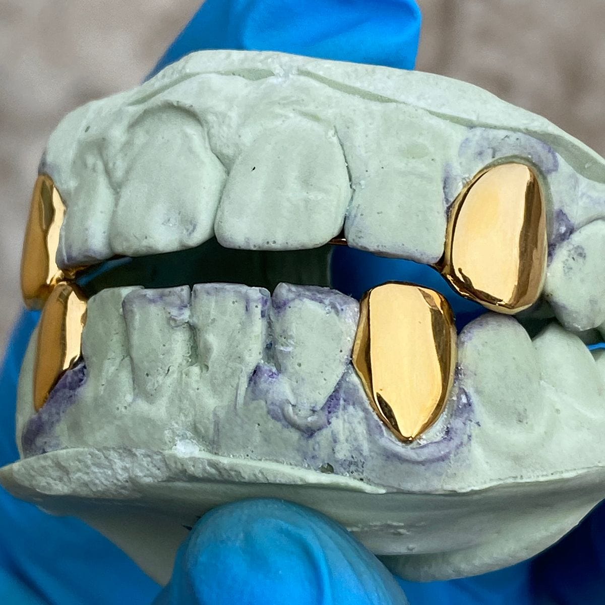 Gold Plated over 925 Silver 4 Single Caps w/Back Bars Custom Grillz