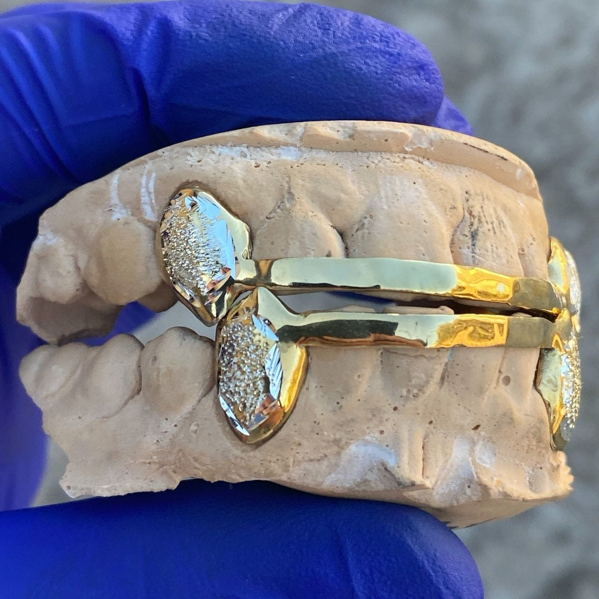 Gold Plated 925 Silver Diamond Dust Fang Custom Grillz – Bling Cartel