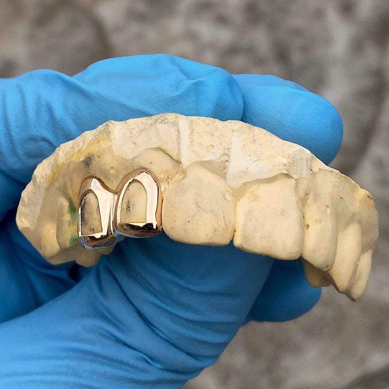 Gold Plated over 925 Silver Double Side Canine Open Face Caps Custom G