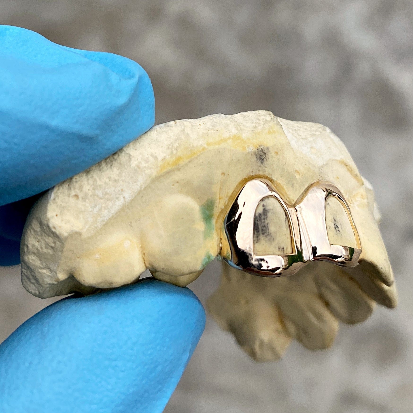 Gold Plated over 925 Silver Double Side Canine Open Face Caps Custom G