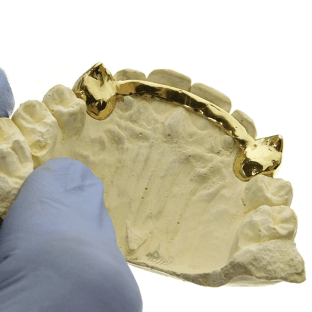 Gold Plated over 925 Silver Two-Tone Diamond Dust Custom Vampire Fangs