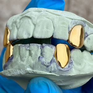 Gold Plated over 925 Sterling Silver Custom Canine Caps Teeth Grillz