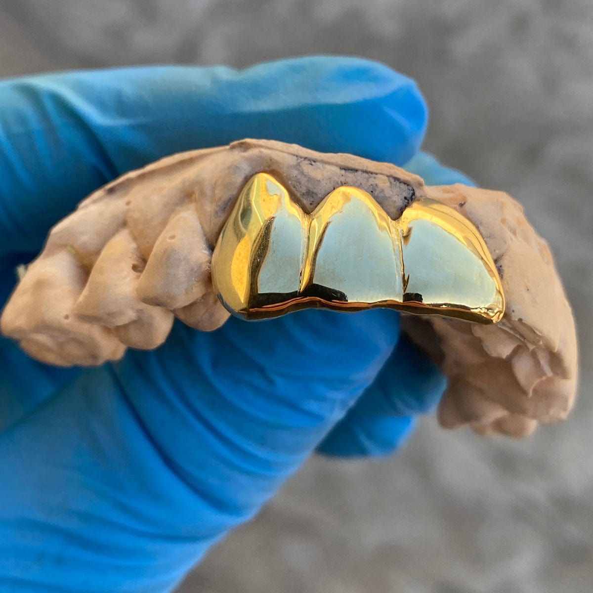 Gold Plated over 925 Sterling Silver Three Teeth Custom Grillz