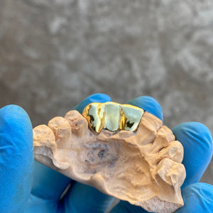 Gold Plated over 925 Sterling Silver Three Teeth Custom Grillz