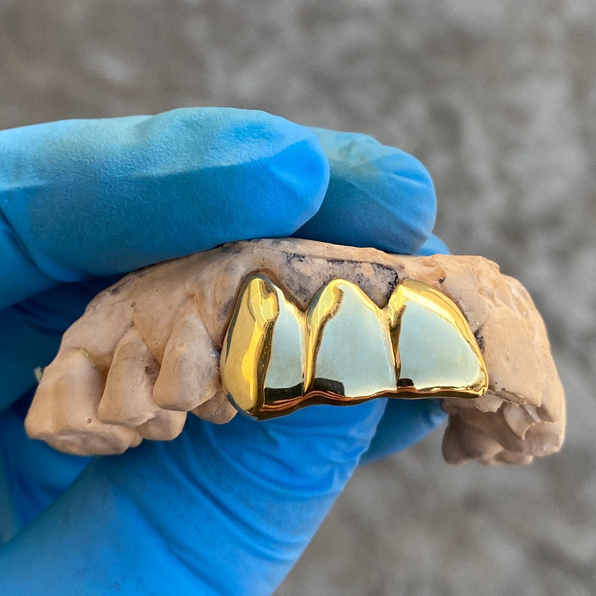 Gold Plated over 925 Sterling Silver Three Teeth Custom Grillz