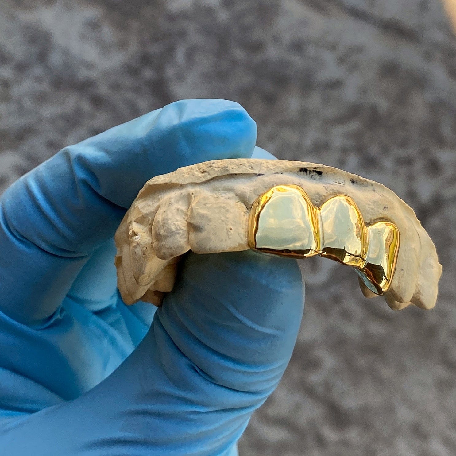 Gold Plated over 925 Sterling Silver Three Teeth Custom Grillz